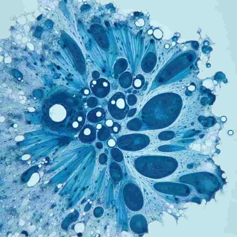 Toluidine Blue for Microscopy in Delhi, Madurai, Chennai, Bangalore ...